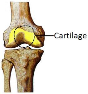 Difference Between Bones and Cartilage (with Comparison Chart) - Bio ...