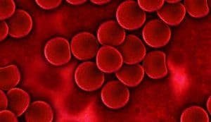 Difference Between Red blood cells (RBC) and White blood cells (WBC ...
